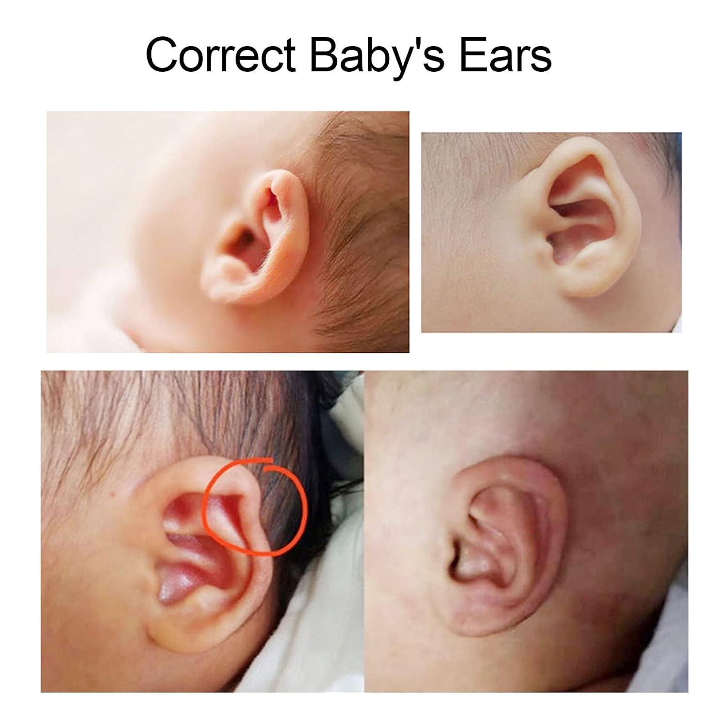 Baby Ear Corrector: Auricle Valgus Bouncers Rocker Oto Stick Patch ...
