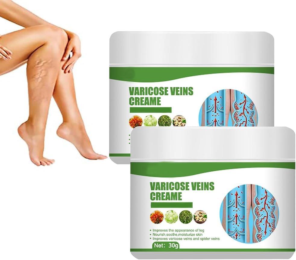 Varicose Veins Cream - 2pcs for Relief of Phlebitis, Angiitis ...