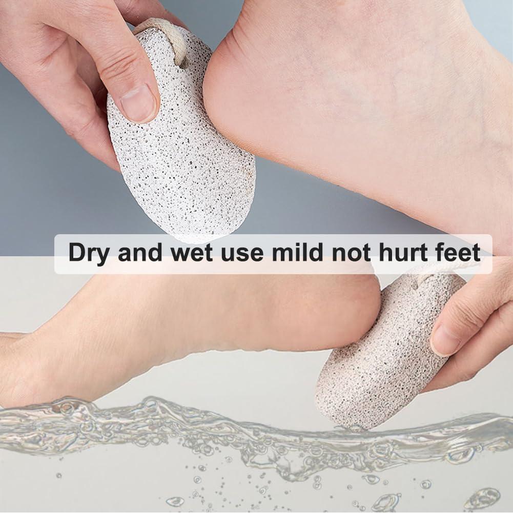 2-Piece Nature Pumice Stone & Lava Scrubber Set | Effective Dead Skin ...