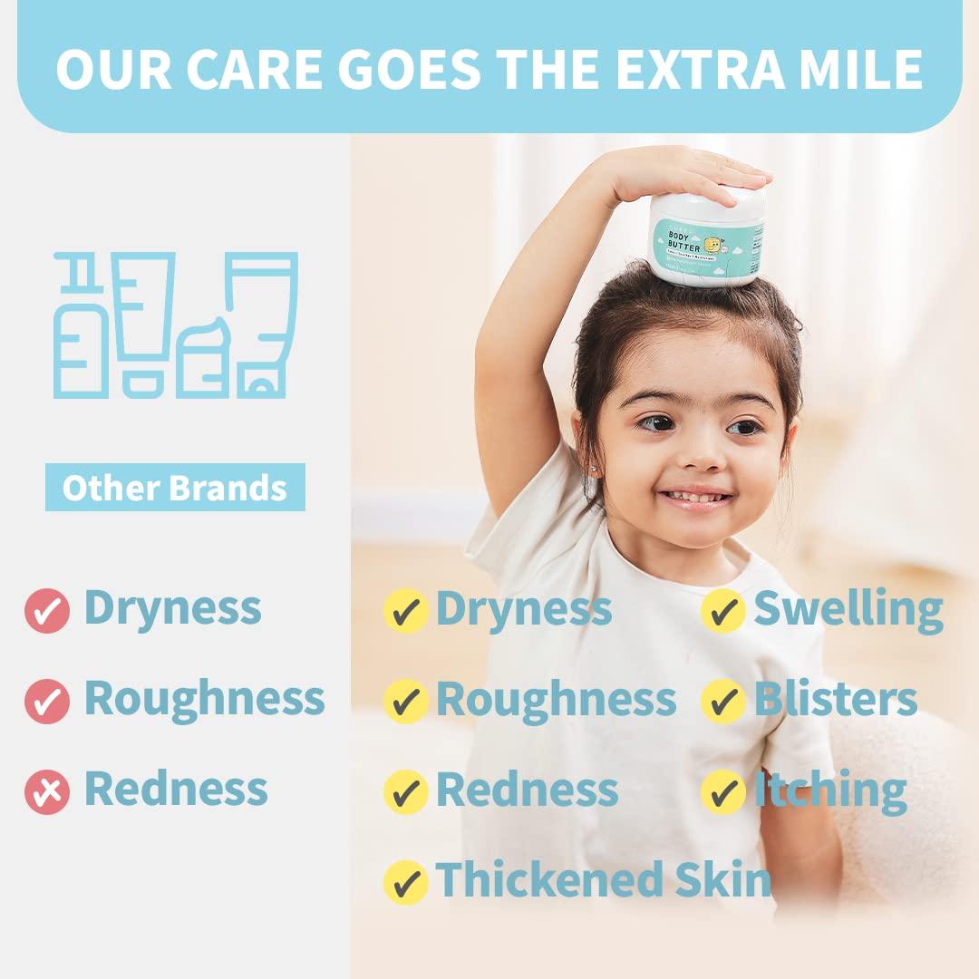 Cubed Eczema Body Butter for Kids with Honey and Oatmeal - Soothing Anti-Itch Cream for Dry ...