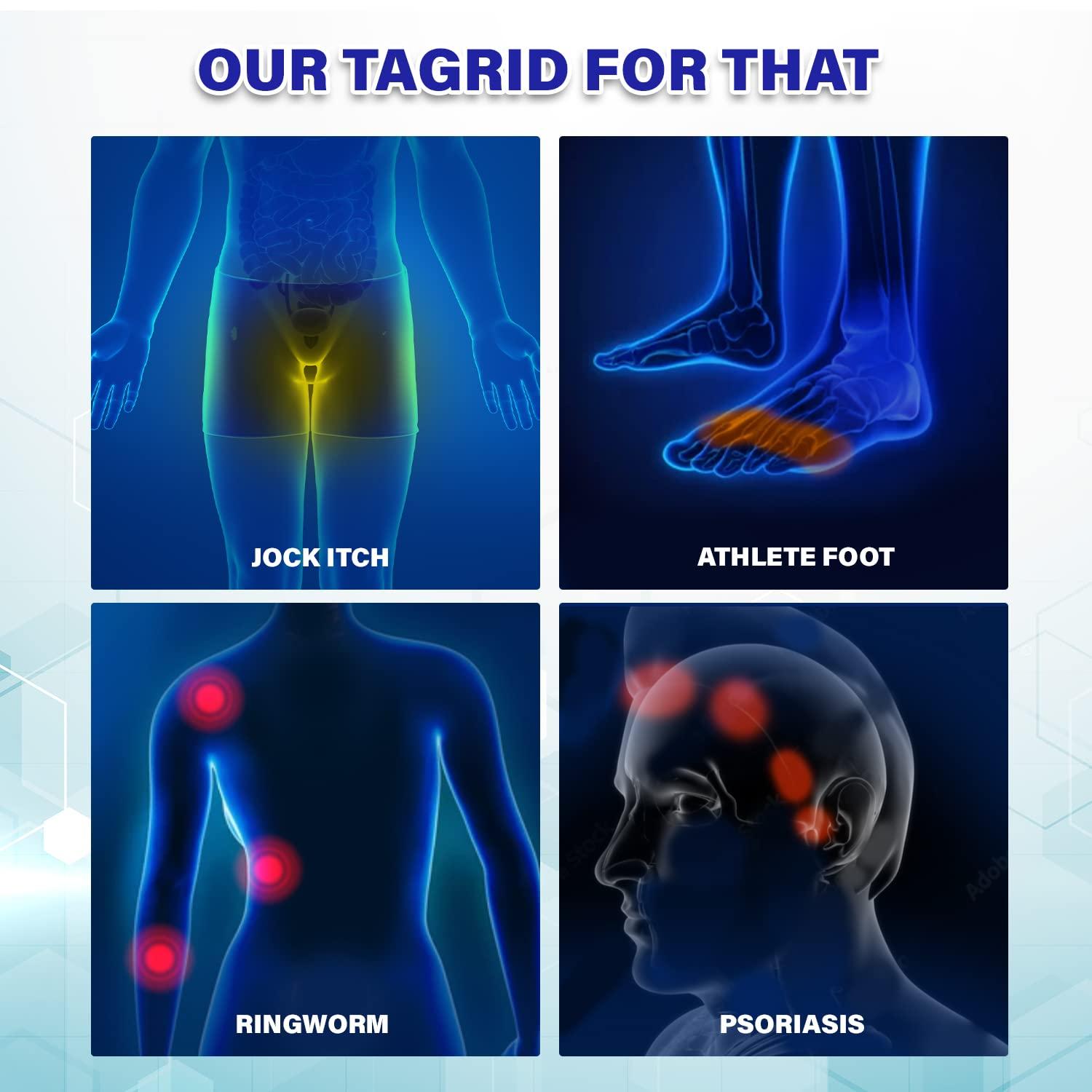 TAGRID Athlete's Foot Treatment Cream 100mL - Jock Itch & Athletes Foot ...