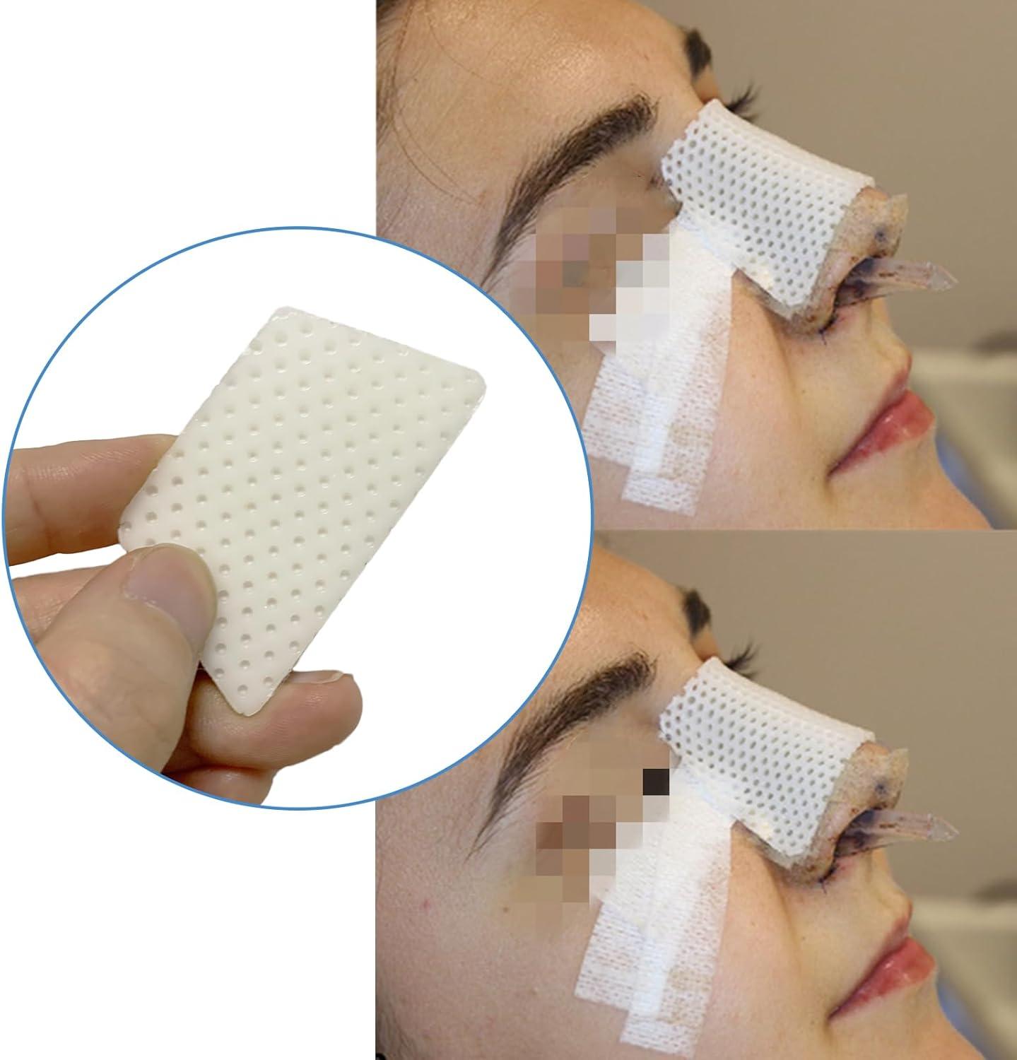 septoplasty splints out