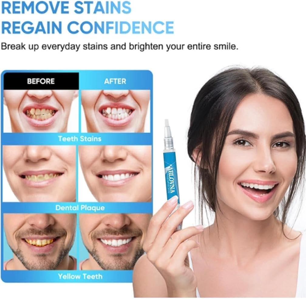 Teeth Whitening Pen 4 Pack Brighten Your Smile in Just 1 Week with ...