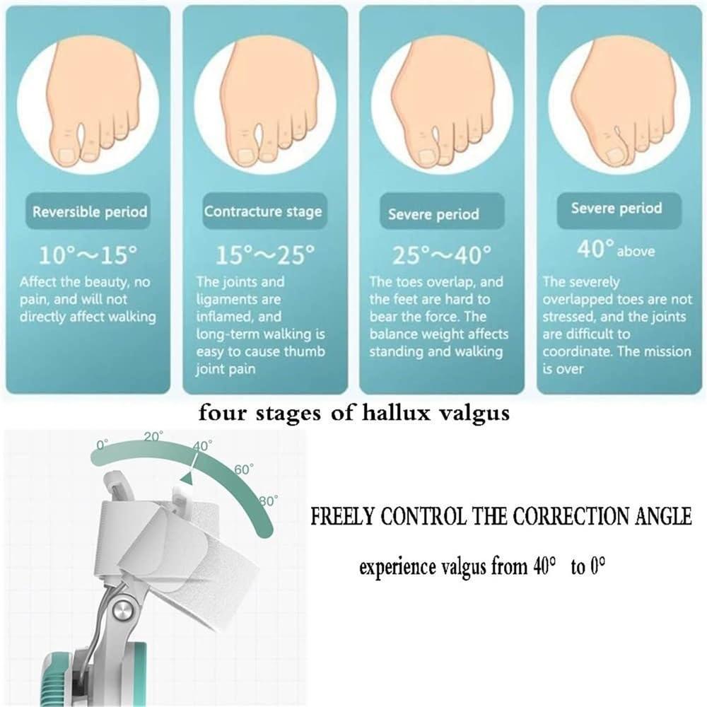 Big Toe Straightener & Bunion Orthosis - Adjustable Bunion Splint for ...