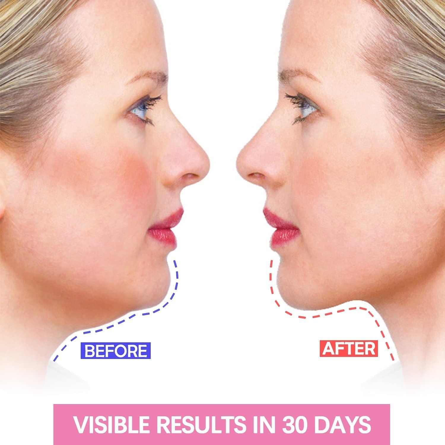 Double Chin Reducer Jaw Eliminator V Line Lifting Mask with Chin Strap ...