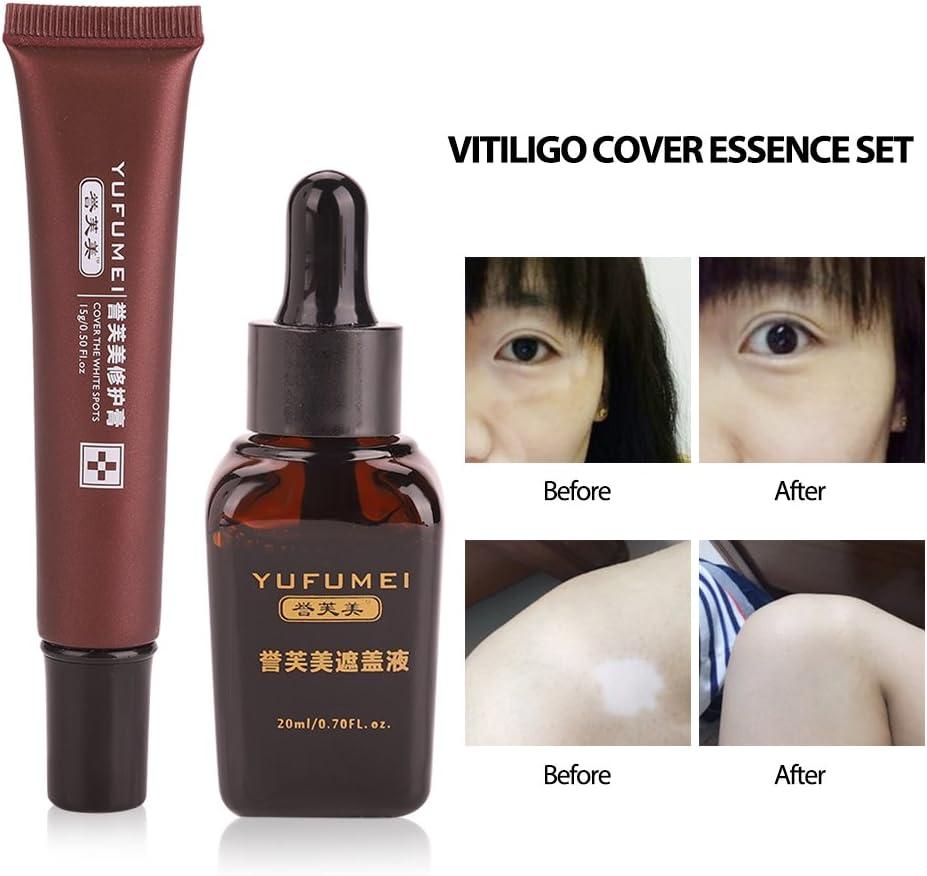 Vitiligo Concealer Repair Cream | Professional Scar Coverage Spot ...