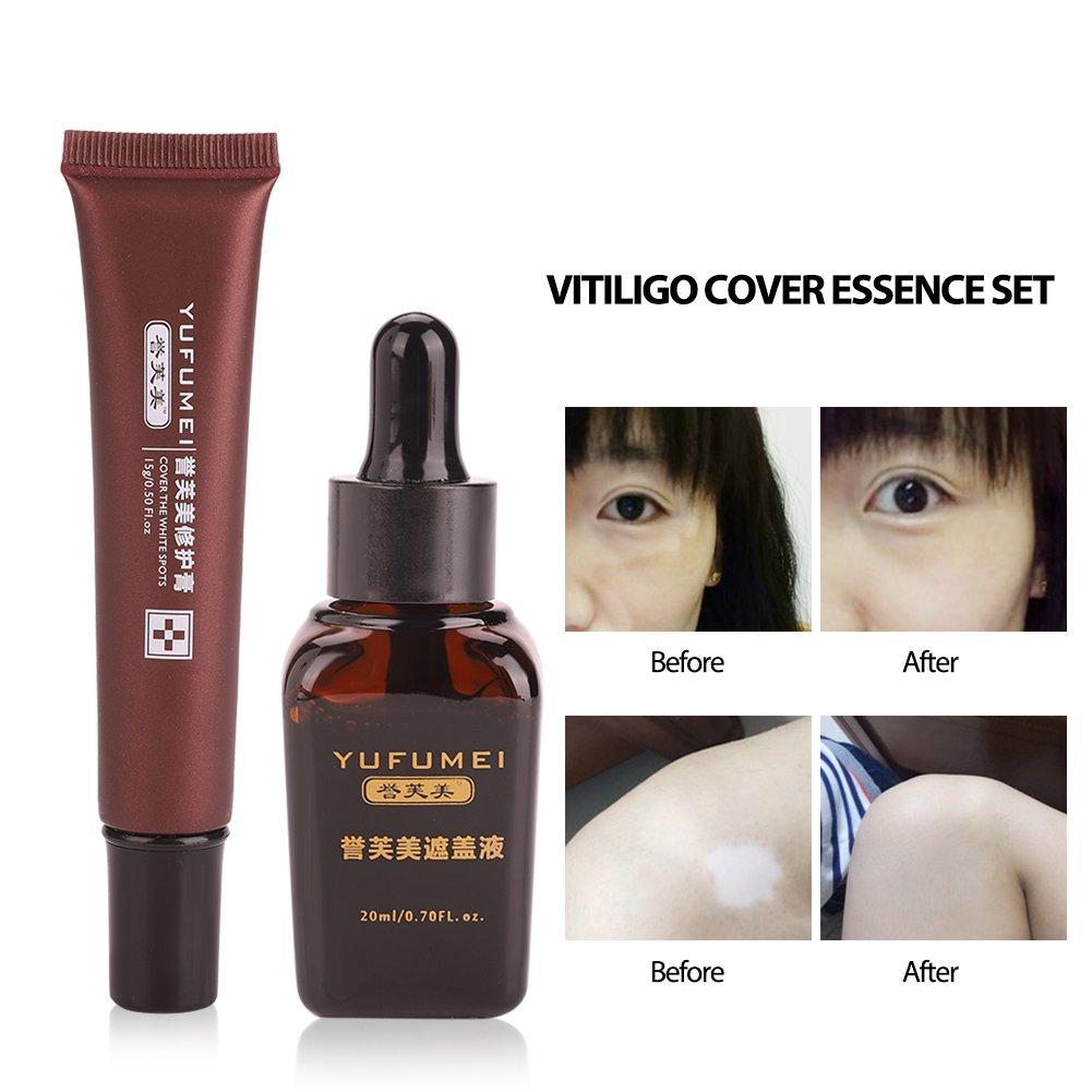 Cimenn Professional Vitiligo Cover Liquid Set - Scar & Birthmark ...