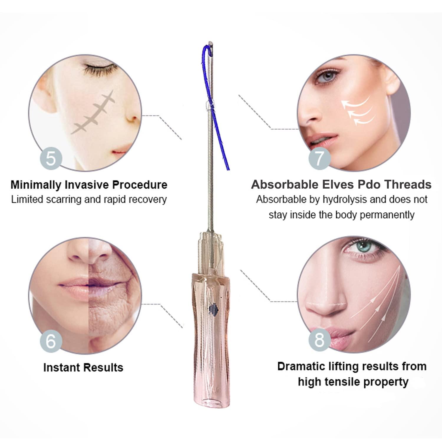 Elves PDO Nose Thread Lift/Nasal 4d COG Pdo Threads for Nose - 19G60mm | Buy Now with Express ...
