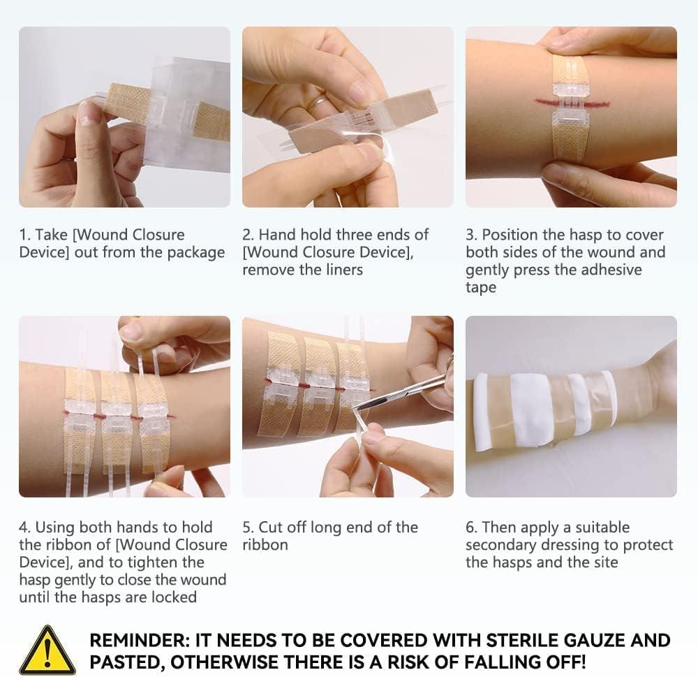Smerphox Wound Closure Strip - Sterile First Aid Band Kit for Emergency ...