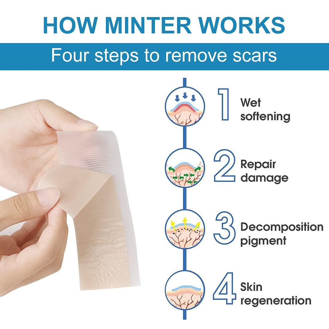 MT Healthy Silicone Scar Removal Sheets - 6 Pcs (5.9 x 1.6 inches) - 3 ...
