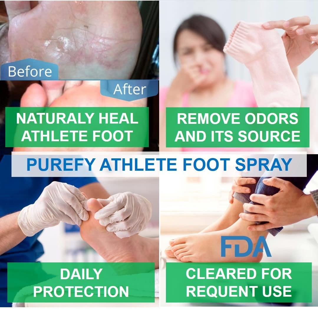 PUREFY Athlete Foot Spray 4oz 2pk - Natural Healing, Odor Removal, No ...