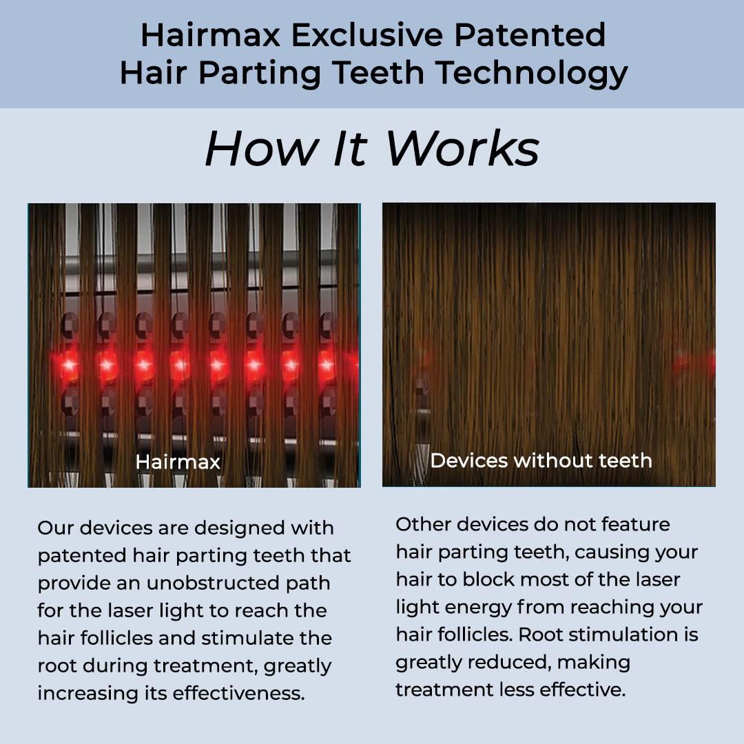 Hairmax ULTIMA 12 Classic Laser Comb for Hair Growth | FDA Cleared ...