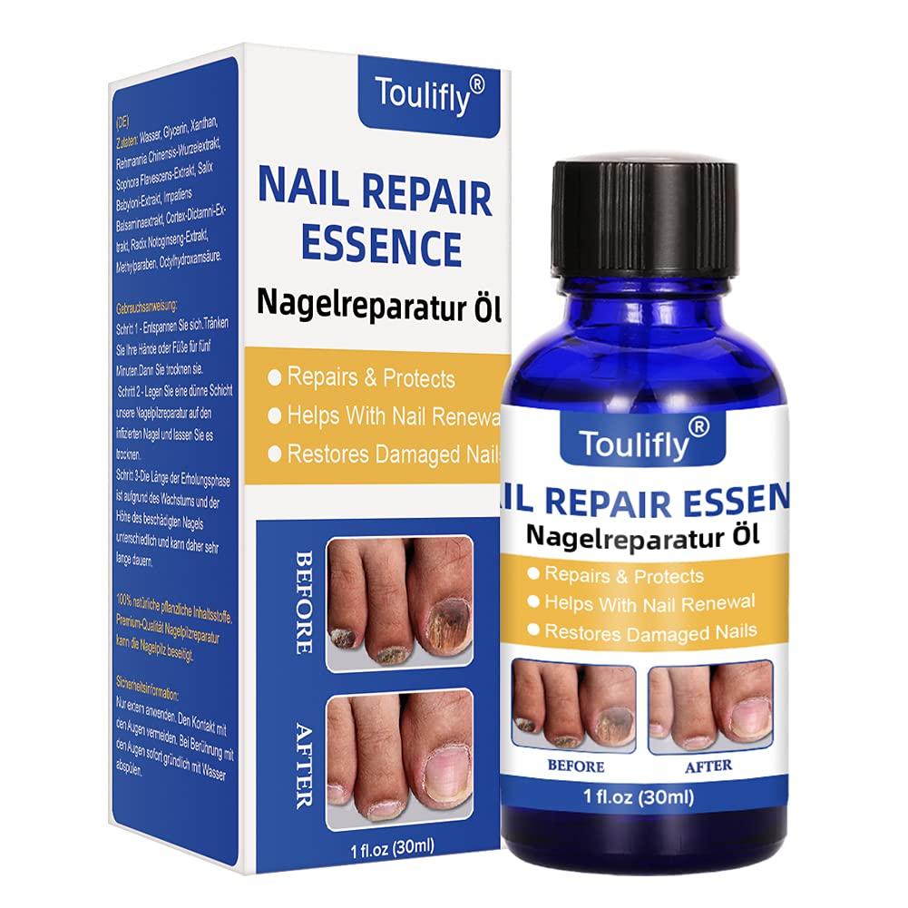 Maximum Strength Nail Repair Solution | Protects Fingernails & Toenails ...