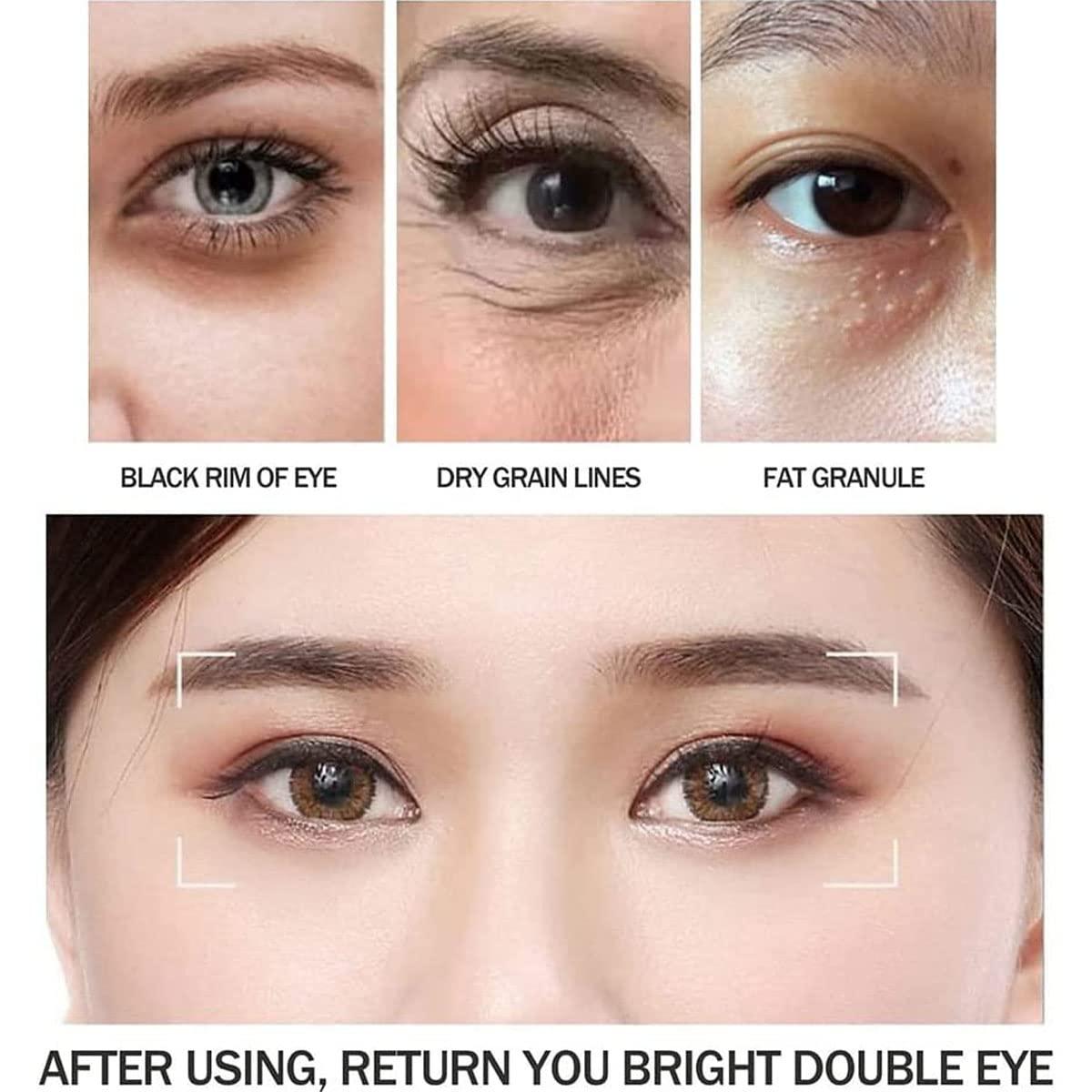 AAOCLO Gold Caviar Electric Wand Eye Cream Set - 20g Eye Repair ...