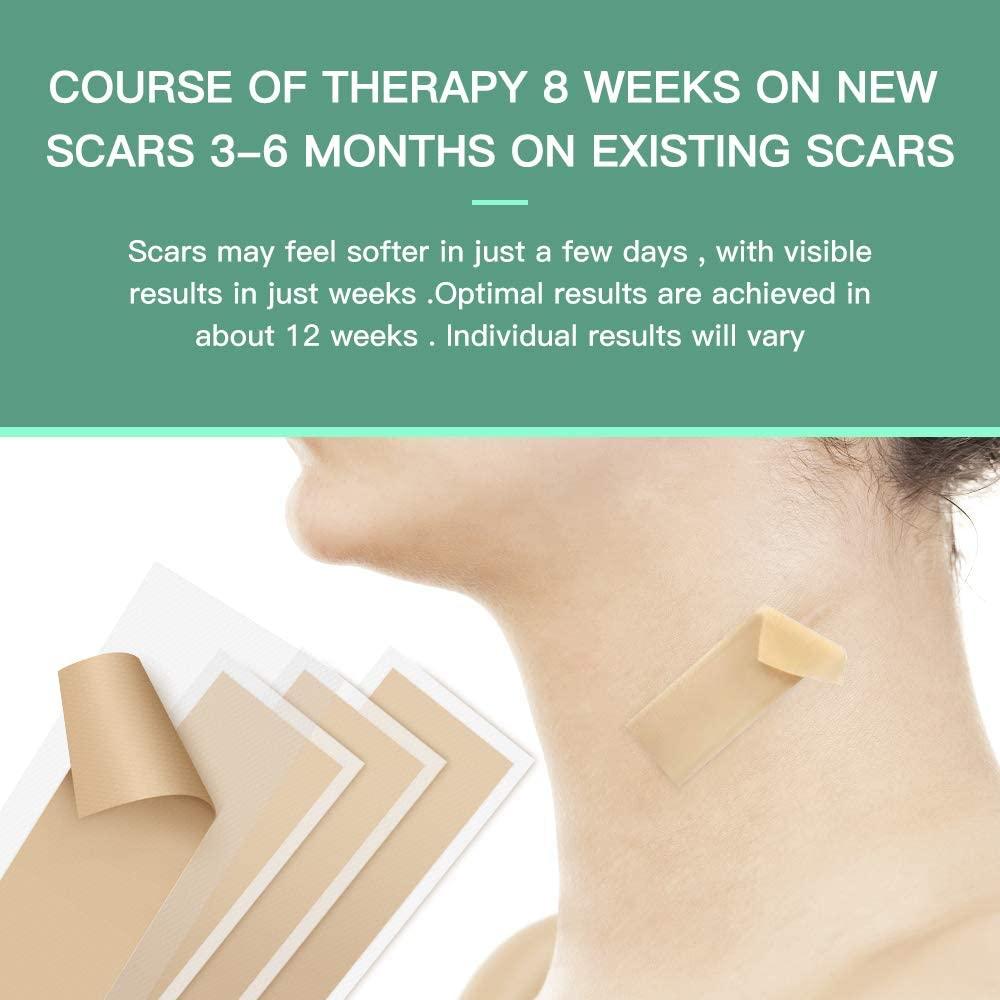 Silicone Scar Sheets - 12 Reusable Patches for Surgery, Burns, C ...