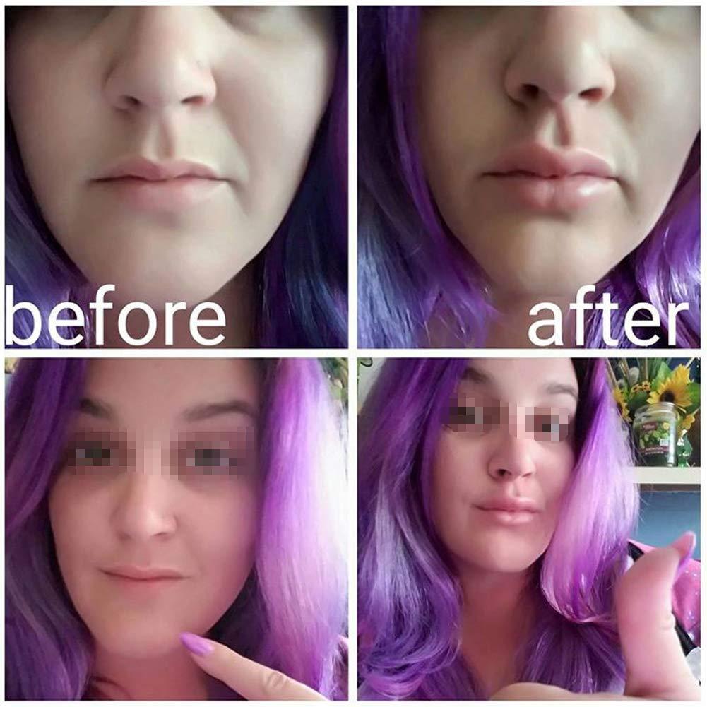 Fish-shaped Silicone Lip Plumper Tool for Full Lips Enhancement | Buy ...