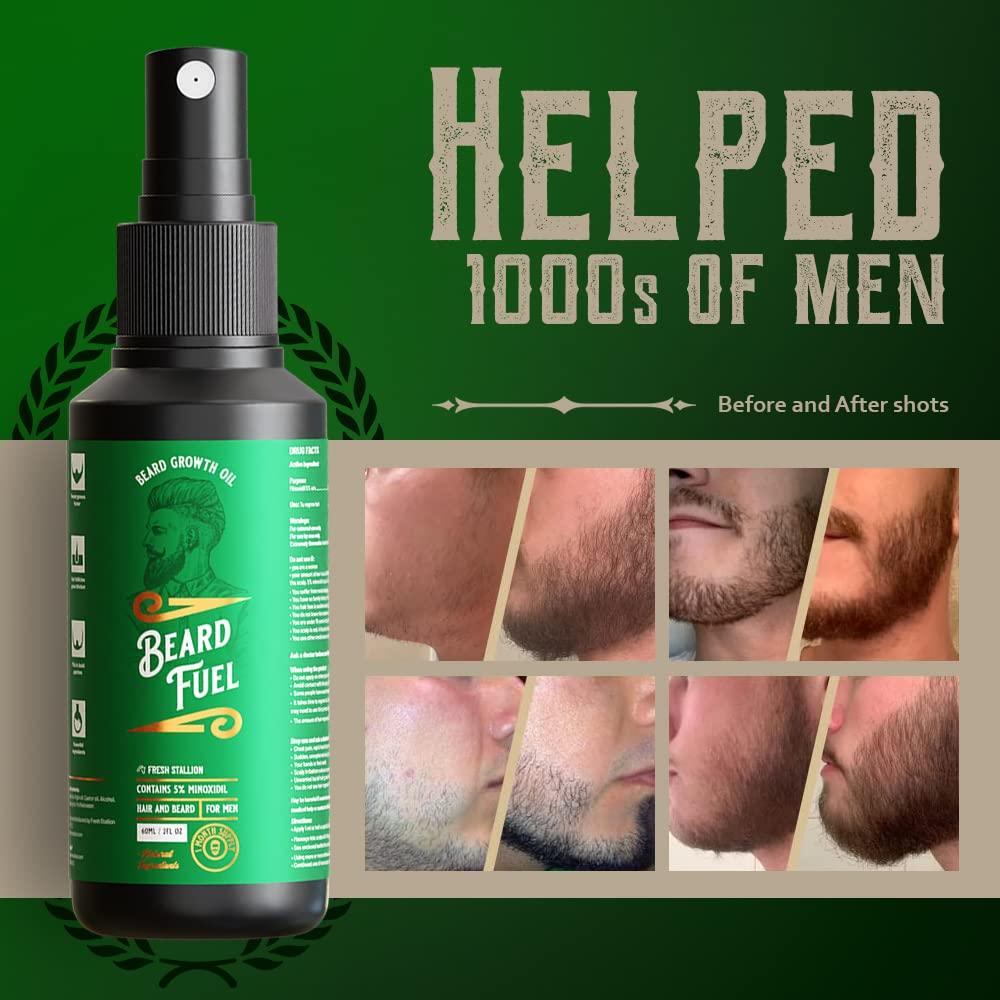 Beard Growth Serum 5% Minoxidil with Biotin - 2 Fl Oz (Pack of 1) | Buy ...