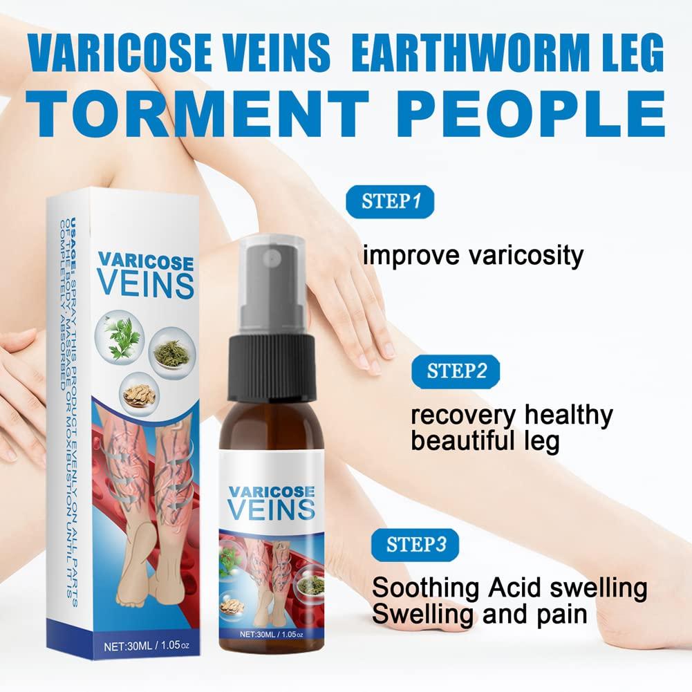 Lichengtai Varicose Veins Miracle Spray - Effective Cream for Varicose ...