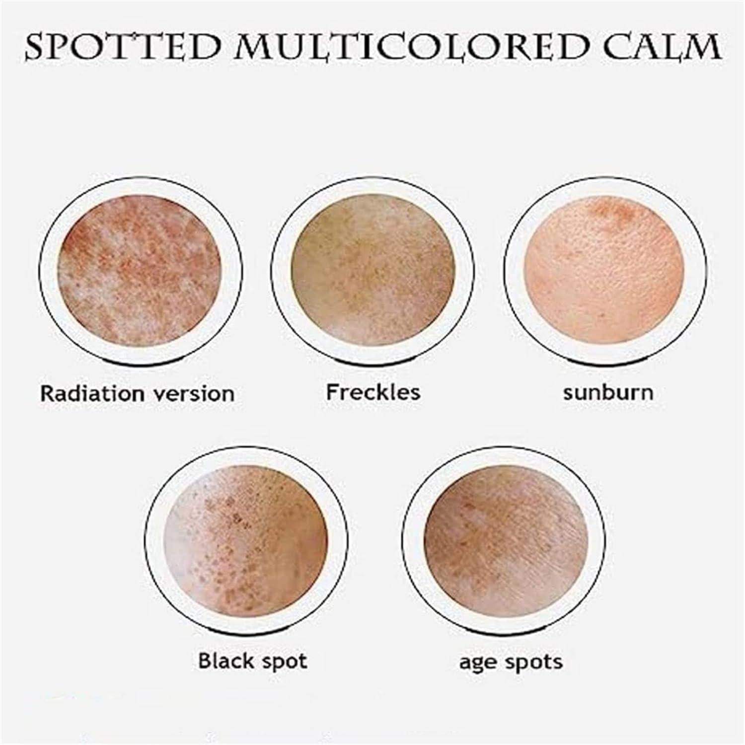 LELEBEAR Japanese Melasma Cream - Skin Care Set for White Spot ...