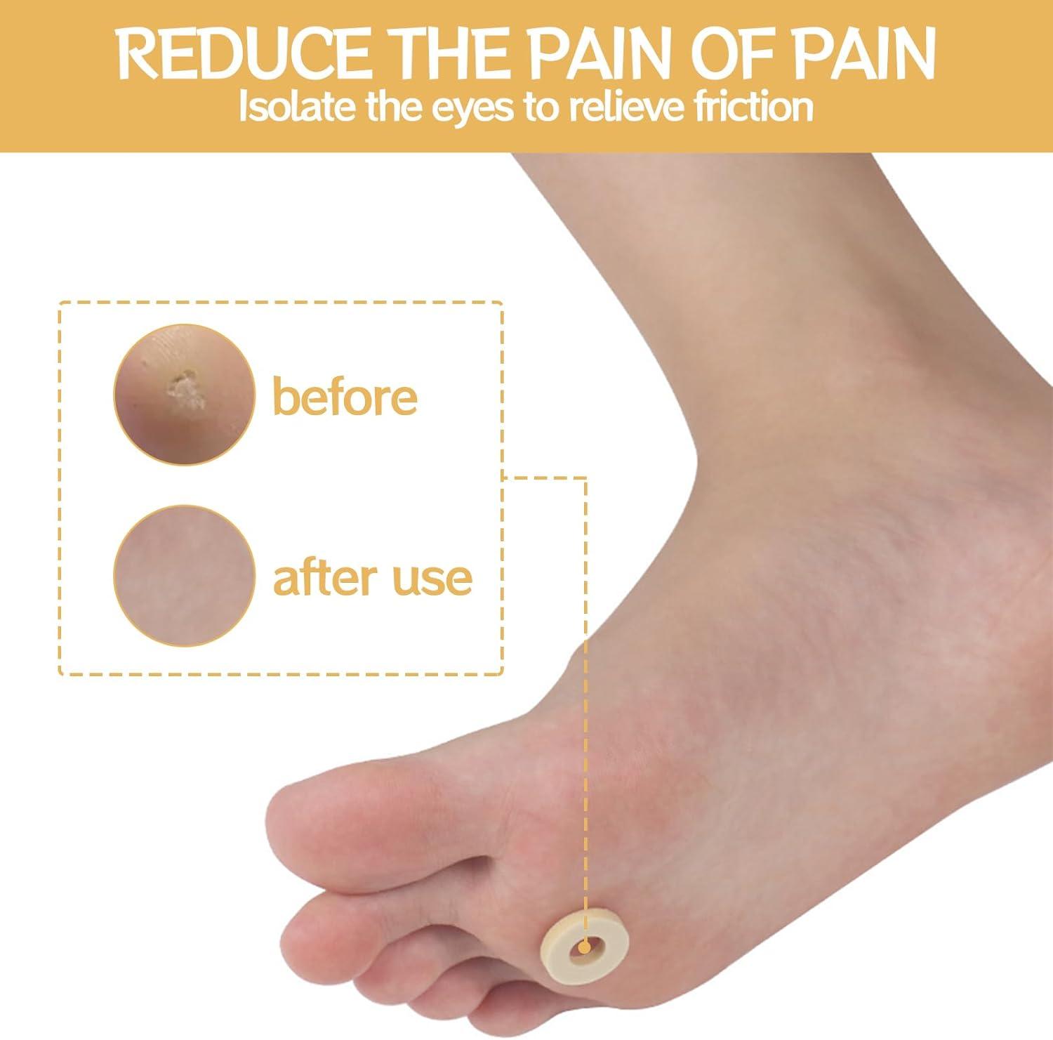 4PCS Latex Sponge Verruca Plasters for Anti Wear Foot Corn Plasters for ...