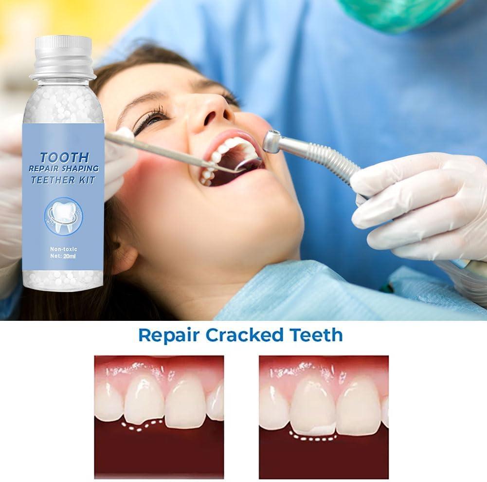 Premium Temporary Denture Set - DIY Heat Fit Beads for Quick Dental ...