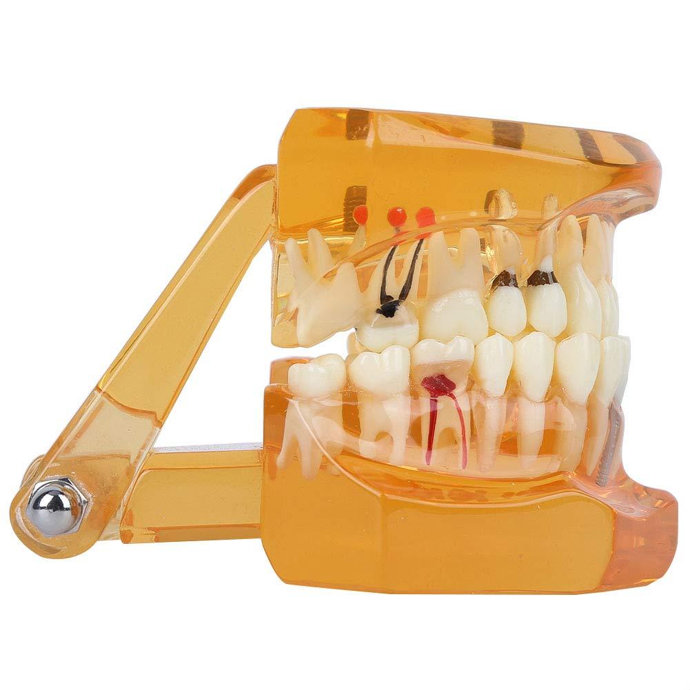 Standard Tooth Model - Removable Dental Teaching Materials for Kids ...