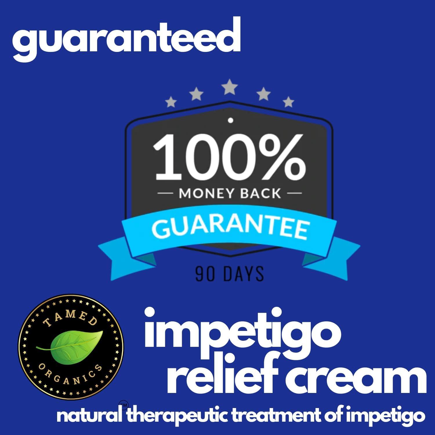 Tamed Organics Impetigo Symptom Relief Cream - Fast Acting Natural ...