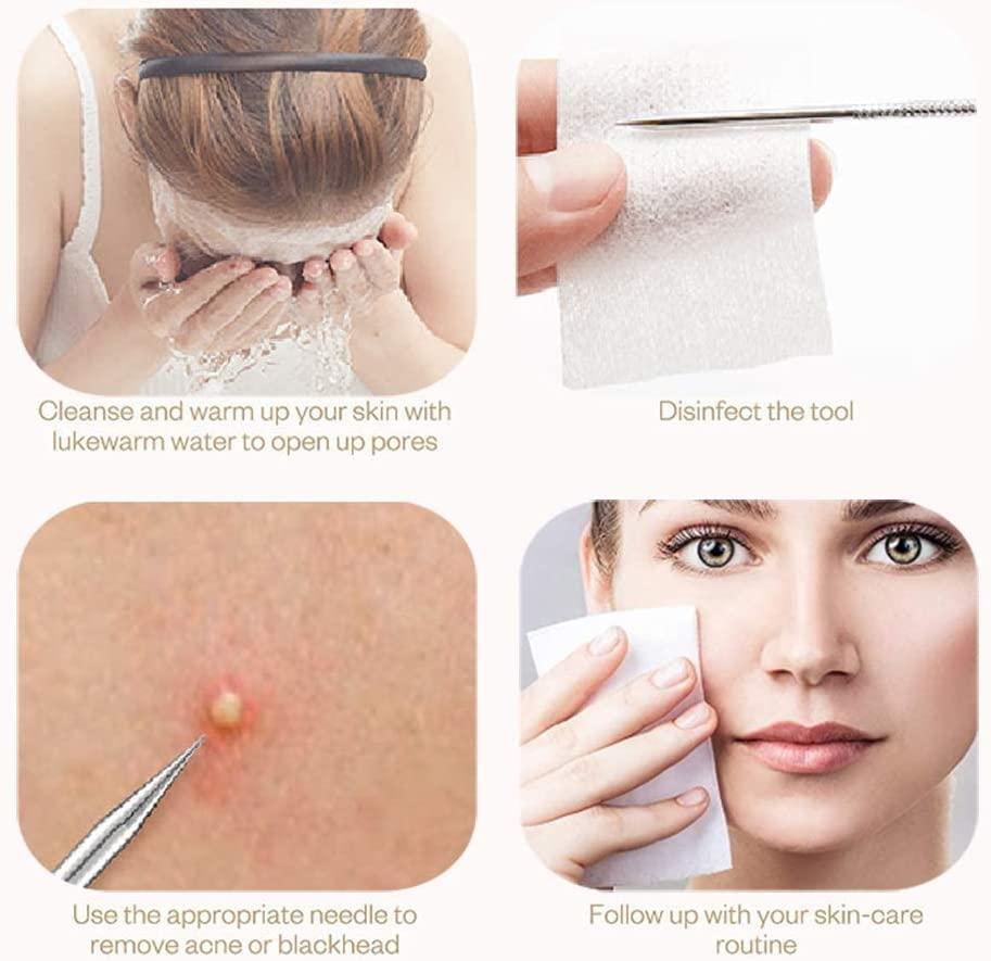 Pimple Popper Tool Kit - VBoo Extraction Tools for Blackhead ...