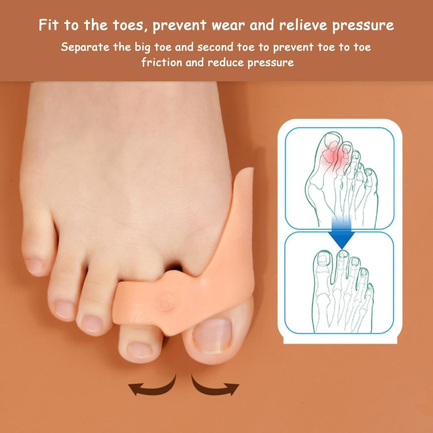 Toe Separator for Overlapping Toes - 2 Gel Toe Spreaders for Big Toes ...