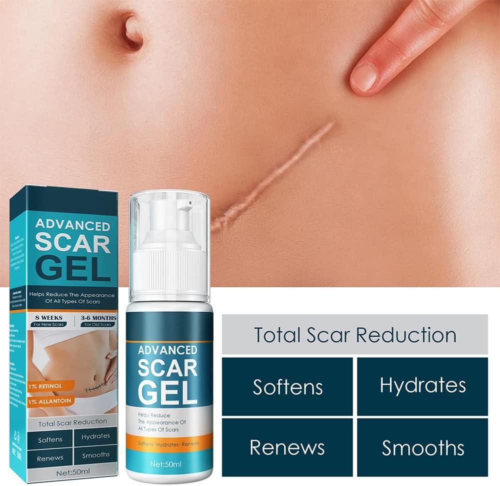 Scar Cream Gel - Fast Absorbing Tummy Tuck & Keloid Treatment for Acne ...