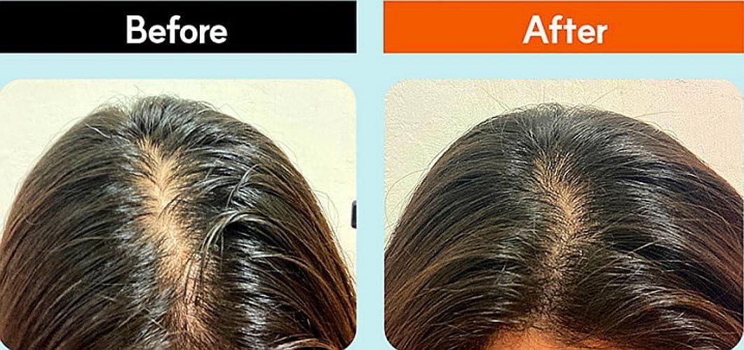 WHITESILK (100ml) THE SCM 85 (human stem cell) + HGF Therapy Anti-Hair ...
