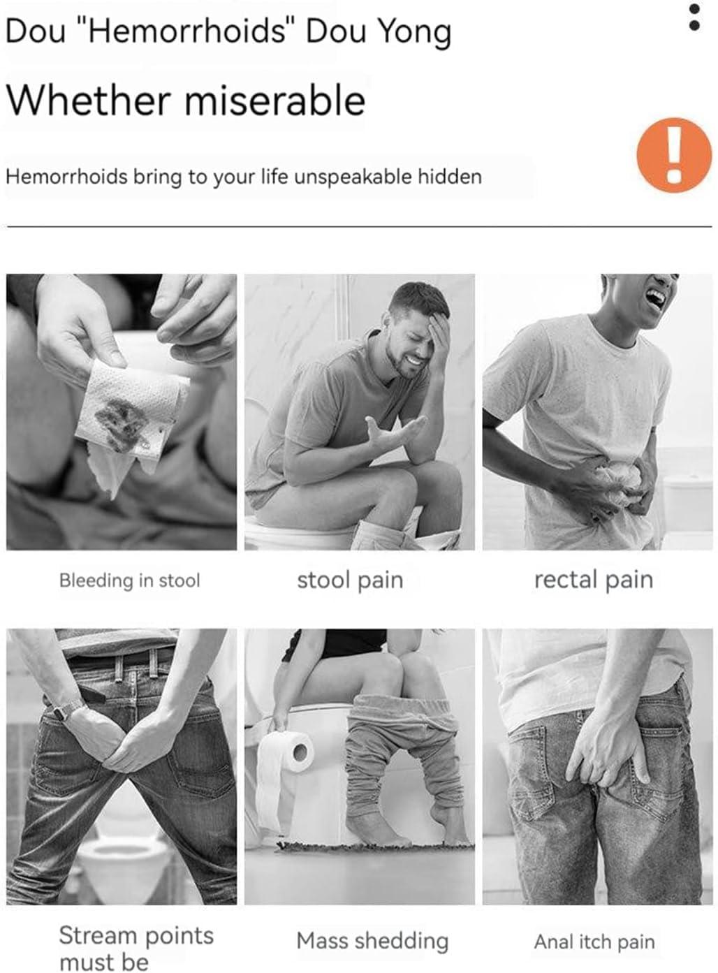 Hemorrhoid & Fissure Cream Hemorrhoid Relief Cream Hemorrhoid Ointment ...