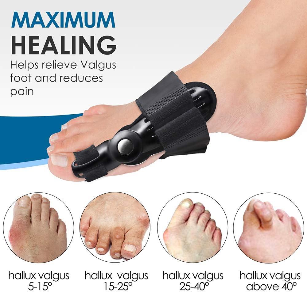 Bunion Corrector Splint - Adjustable Pain Relief & Protection for Women ...