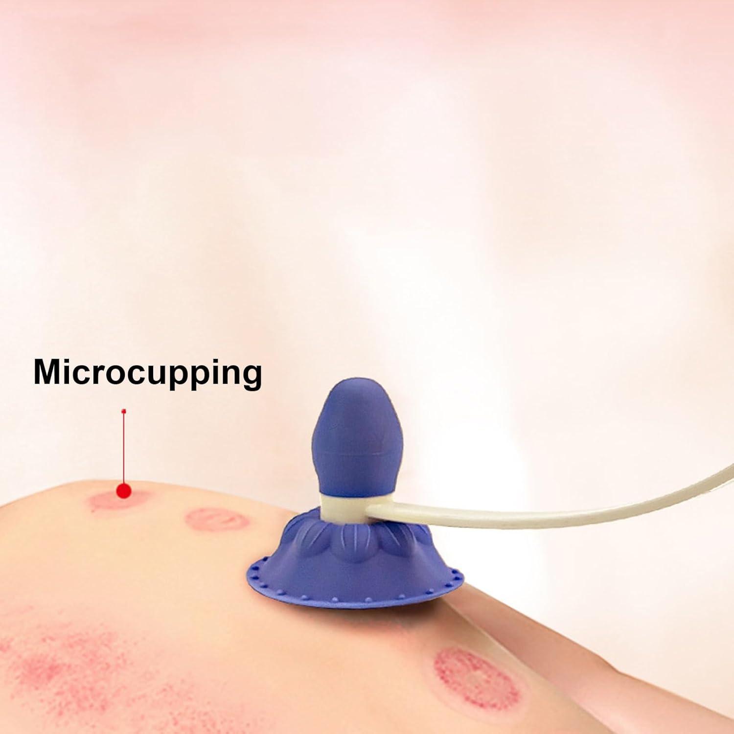 Meridian's Pat Stick Suction Cup Back Massager for Fatigue Relief ...