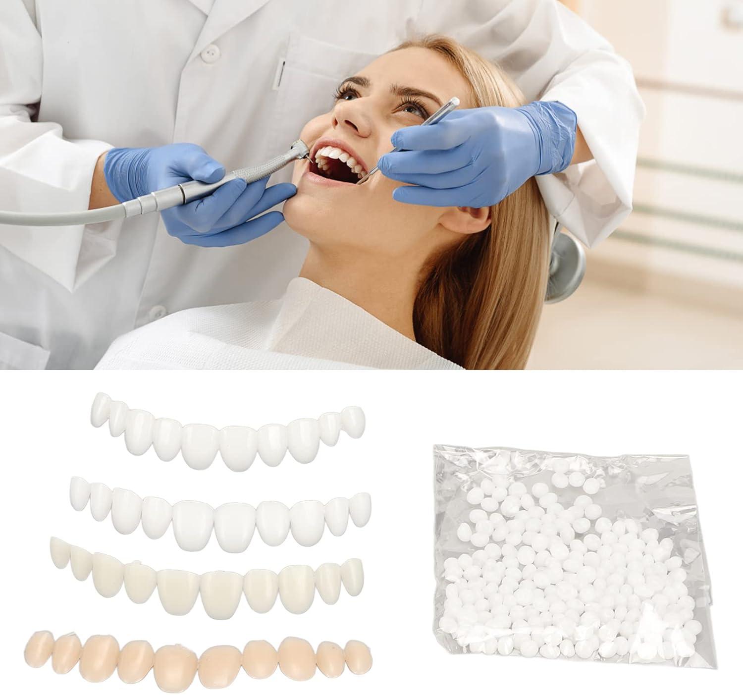 Tooth Filler Bead - Degradable Moldable Gum Repair Kit for Temporary ...