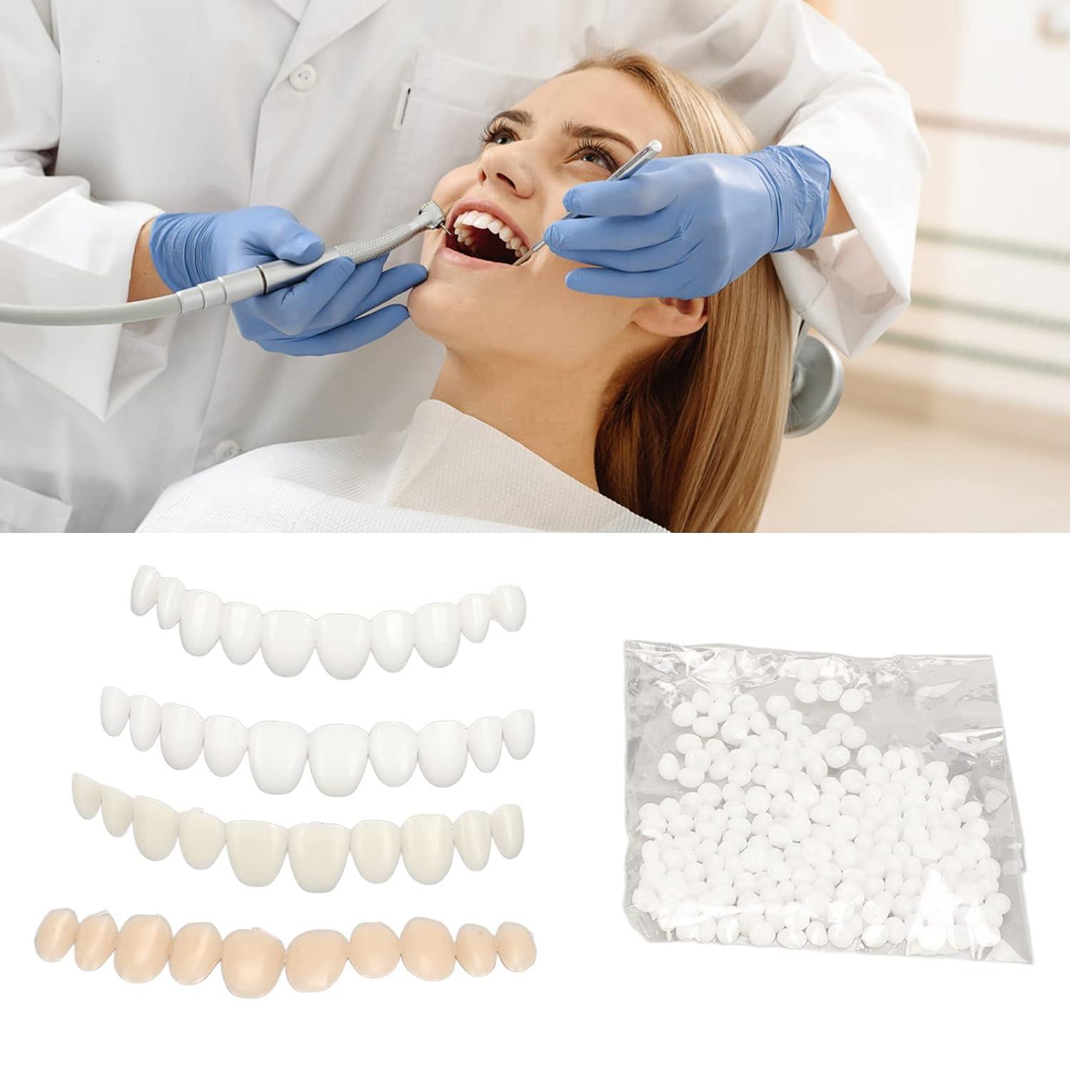 Tooth Filling Pearl Set | Temporary Tooth Repair Kit | Formable False ...