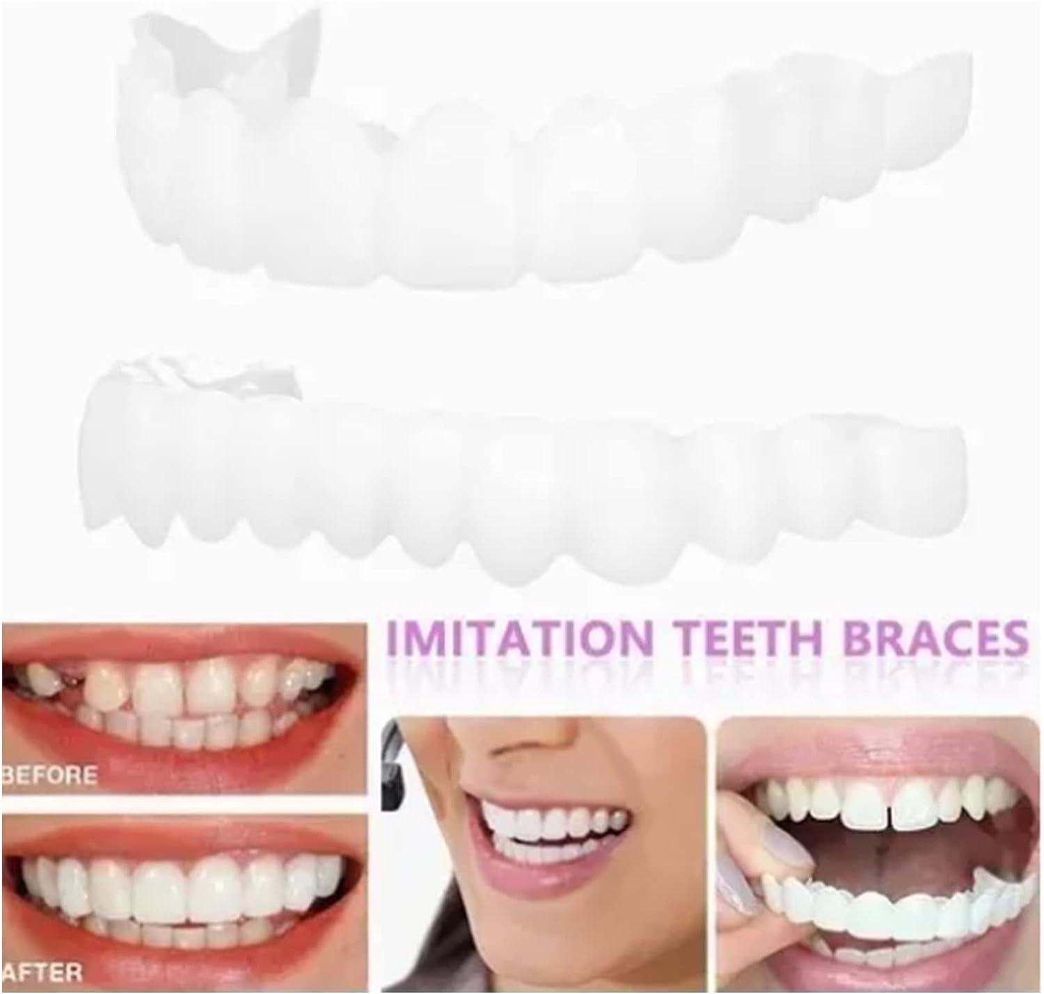 Dentures Teeth Temporary Teeth Braces, Fake Teeth Braces Upper Lower ...