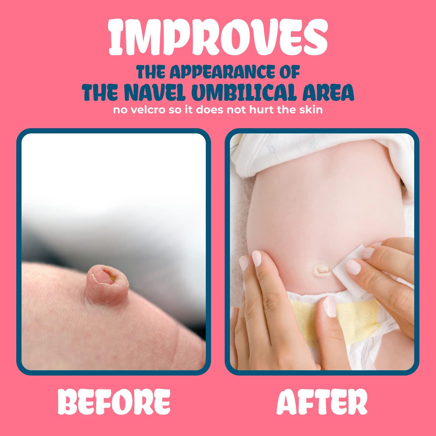 normal belly buttons