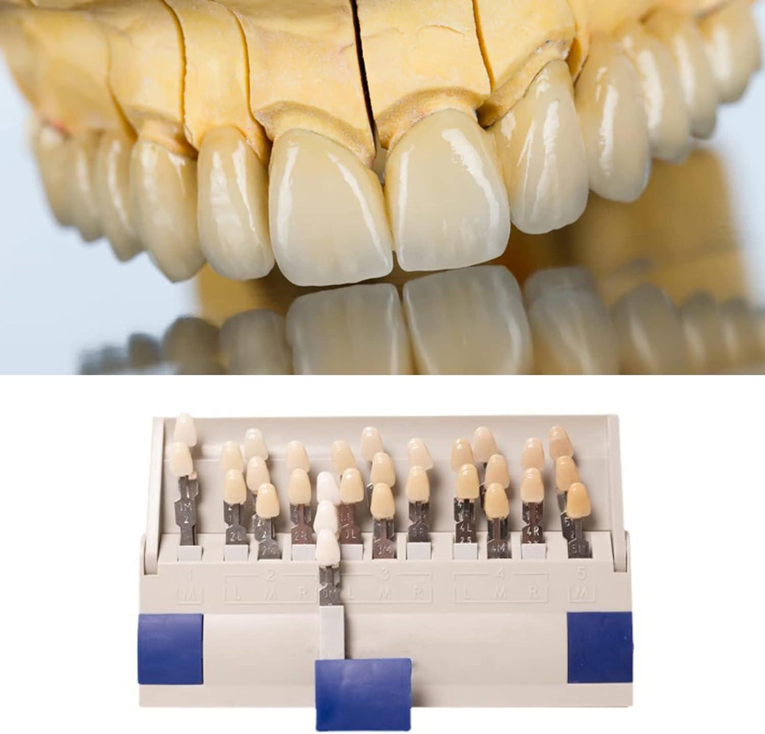 ZJchao Teeth Shade Guide - 29 Removable Color Comparison Chart for ...