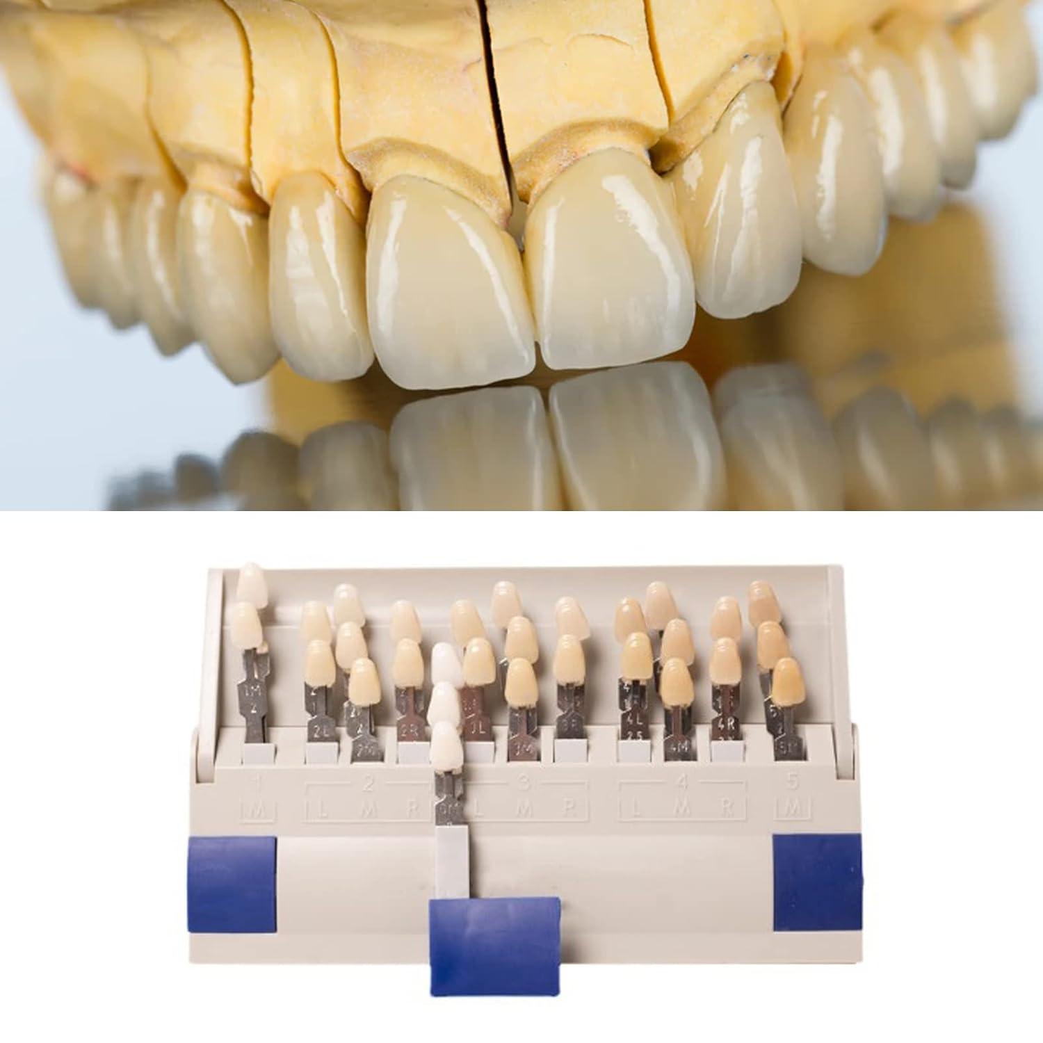 Teeth Whitening Comparison Chart & Color Guide | 29 Shades for Perfect ...