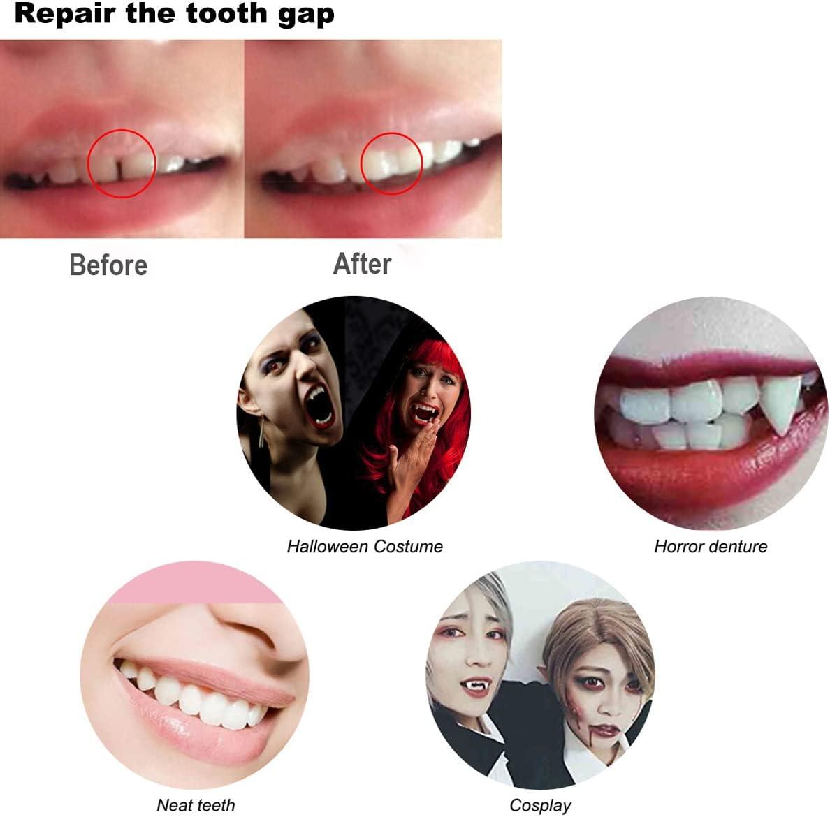 Instant Snap-On Veneers Tooth Repair Kit for Irregular or Missing Teeth ...