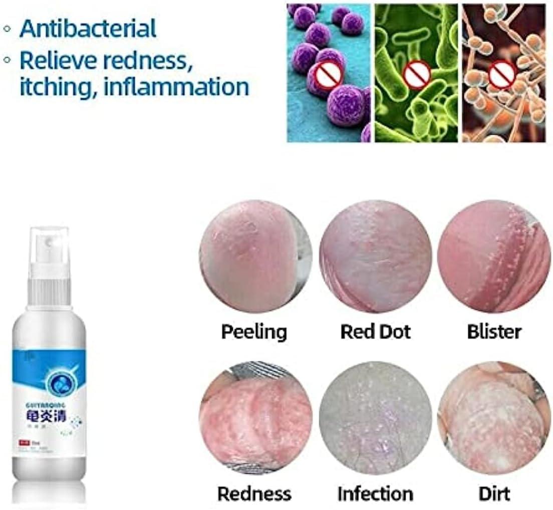 Gimtella Balanitis Relief Ointment - All-Natural Soothing Skin Relief ...