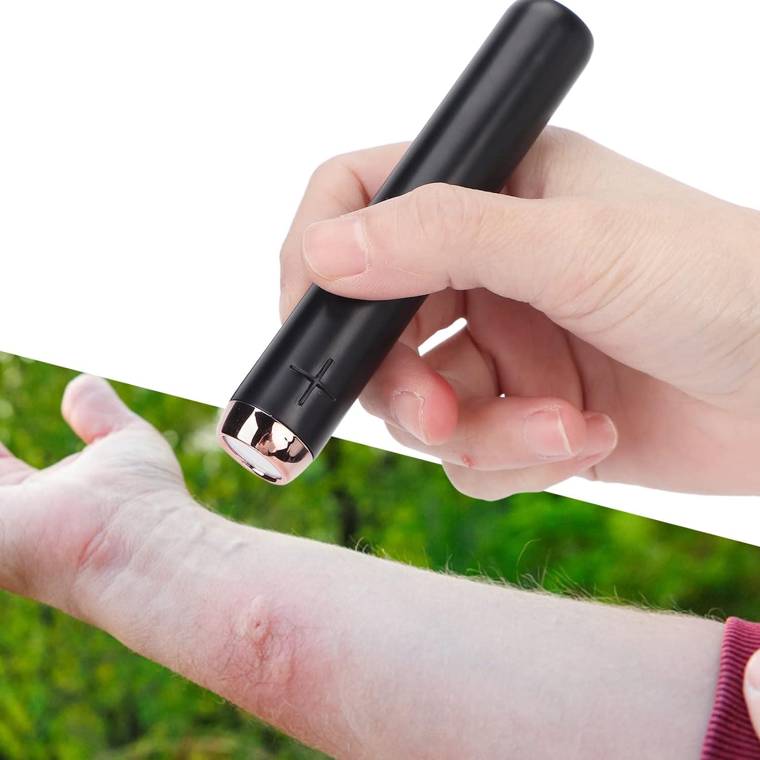 Bite Relief Tool - Itching Relief Device for Outdoor Use | Portable ...