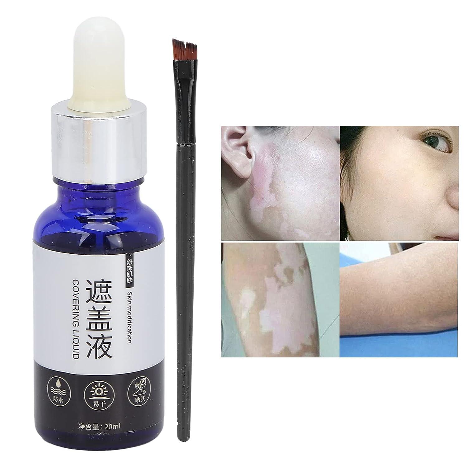 Vitiligo Cover Liquid - Body Makeup for Legs - Men and Women | Buy Now ...