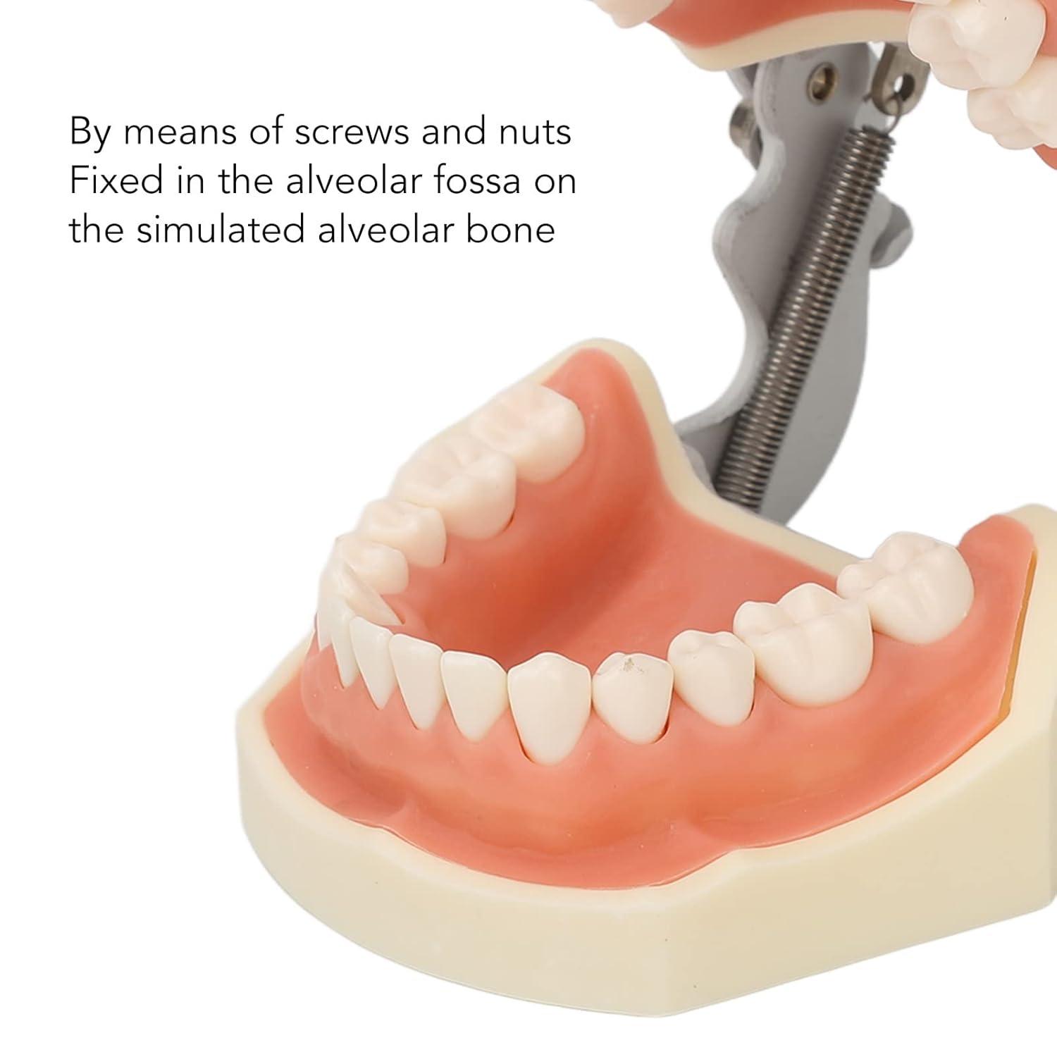 Buy Dental Typodont Teeth Model - 28 Teeth Soft Gums Upper Jaw Cyst ...