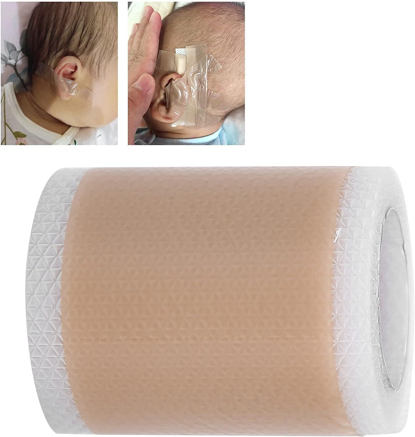 Infant Protruding Ear Patch - Silicone Correctors for Newborns - 4cm ...