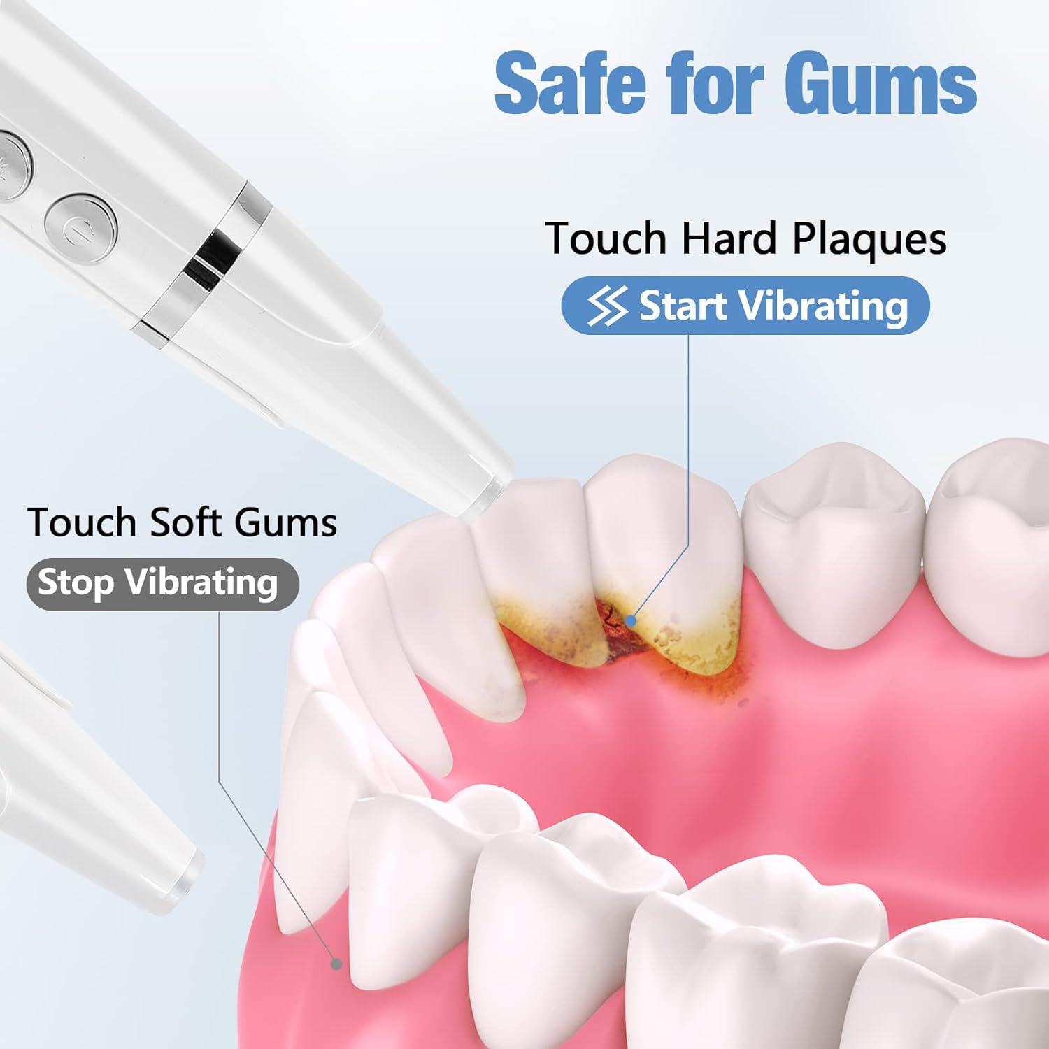 Wagner Stern Teeth Whitening Kit: 5 Modes Plaque Remover for Teeth ...