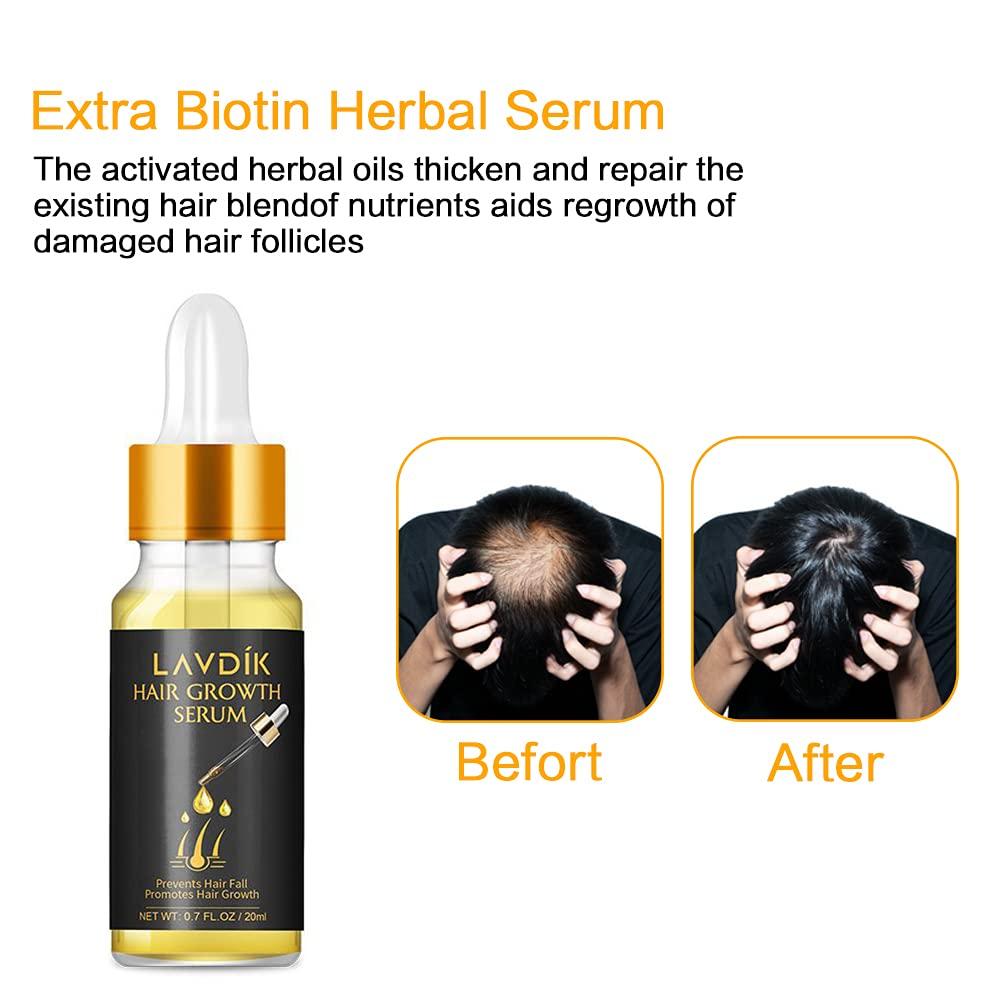 Ysimee Hair Growth Serum 20ml | Biotin & Herbal Anti-Hair Loss Formula ...