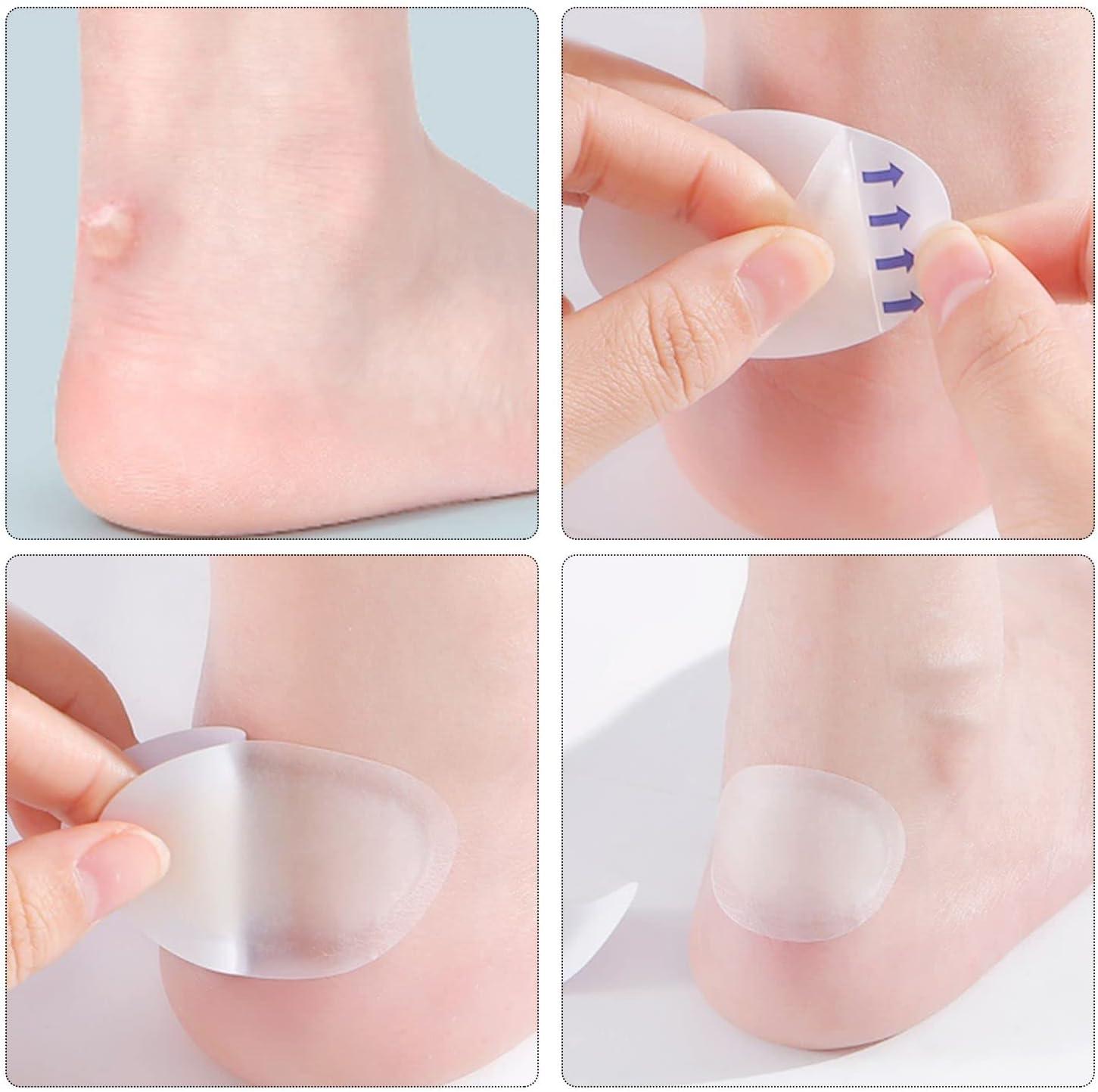 18 Waterproof Hydrocolloid Foot Pads - Pressure Relief & Blister ...