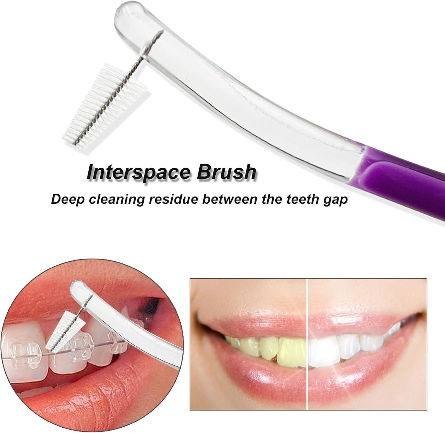 5 Pack Double-Ended Orthodontic Toothbrushes - V-Trim & Interproximal ...